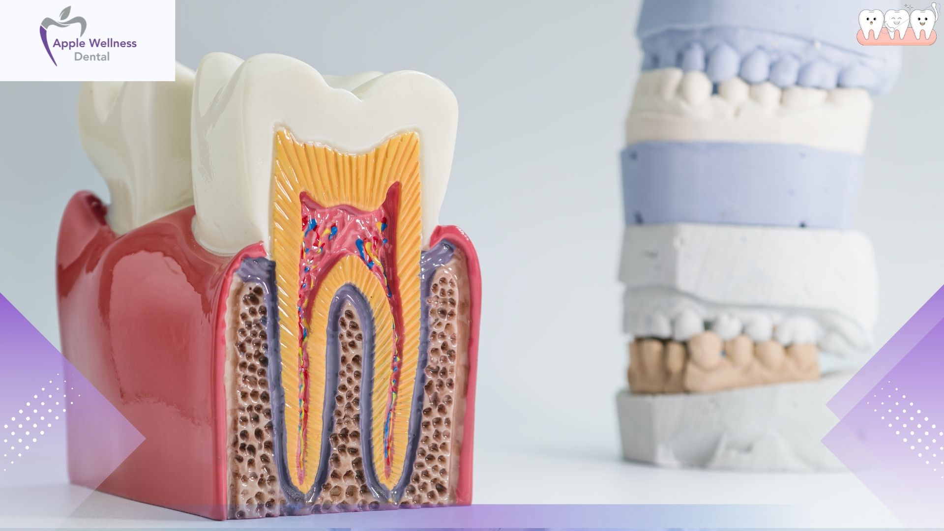 Your Guide To Root Canal Therapy In Airdrie